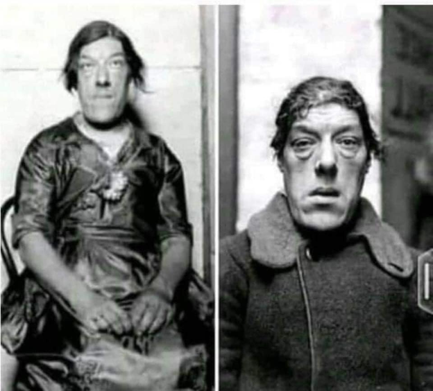 The fascinating and tragic story of Mary Ann Bevan – AMAZING STORY